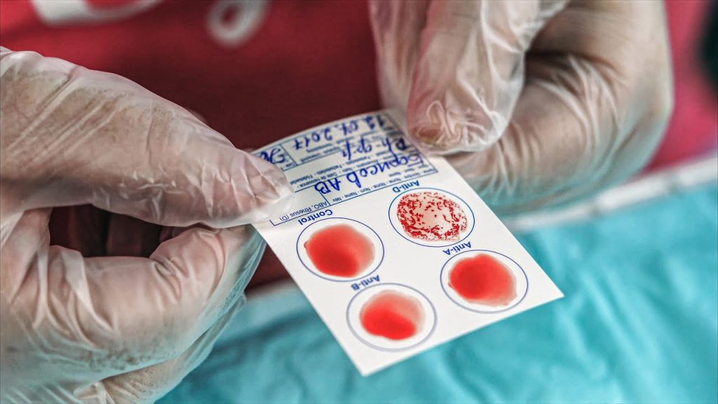 How to Know Your Blood Type at Home or Lab